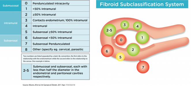 Fibroids - Anthony Siow