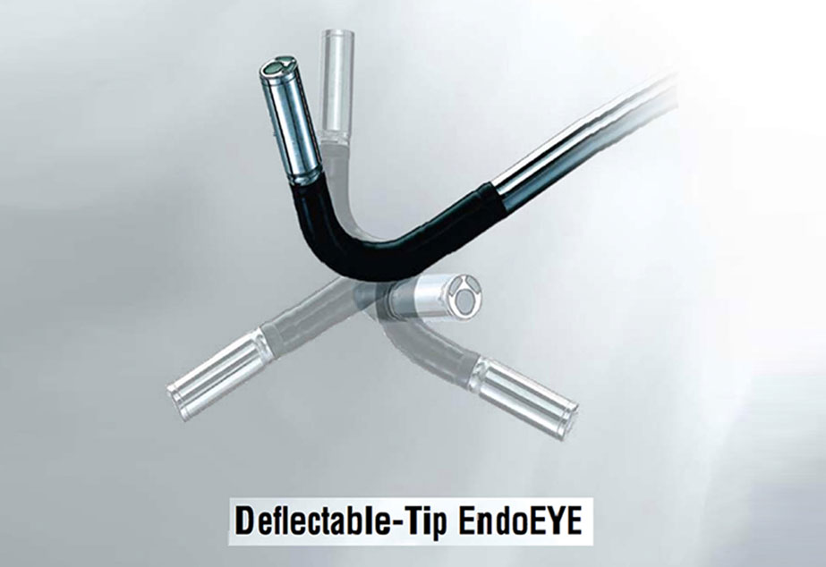 Single Incision Laparoscopy - Anthony Siow