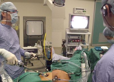 Laparoscopy Keyhole SurgeryMinimally Invasive Surgery - Anthony Siow