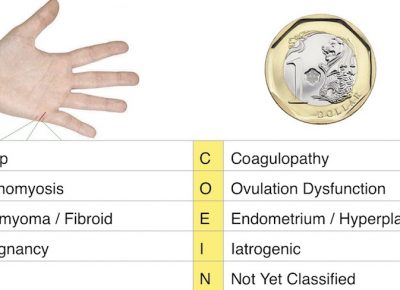 Heavy and Irregular Menstruation - Anthony Siow