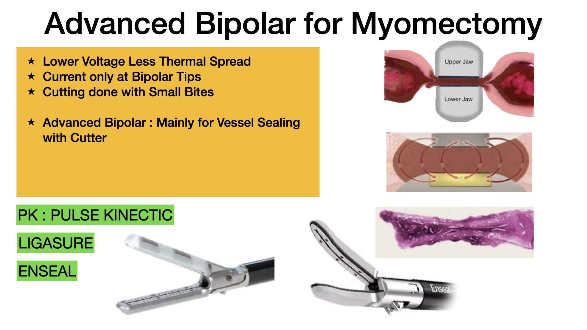 Mastering Surgical Energy for Laparoscopic Myomectomy - Anthony Siow