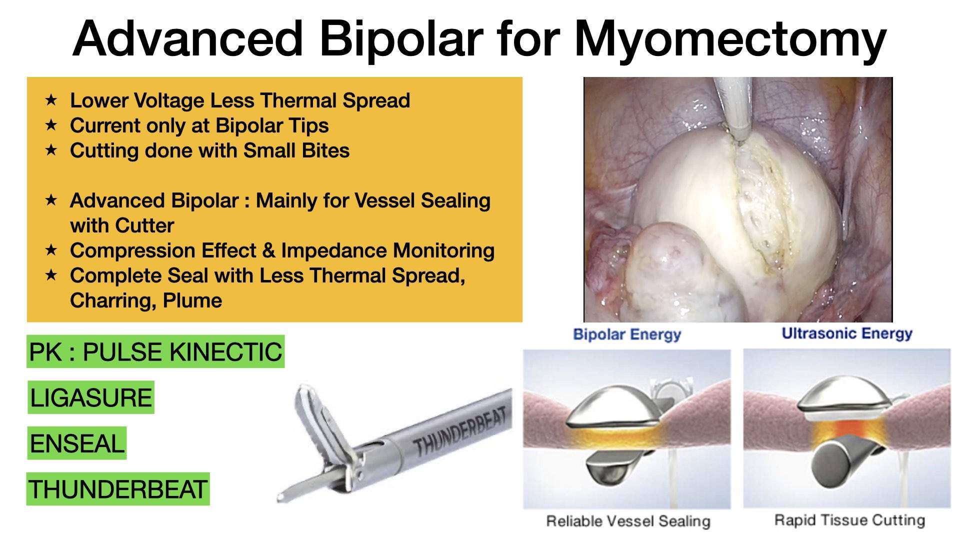 Mastering Surgical Energy for Laparoscopic Myomectomy - Anthony Siow